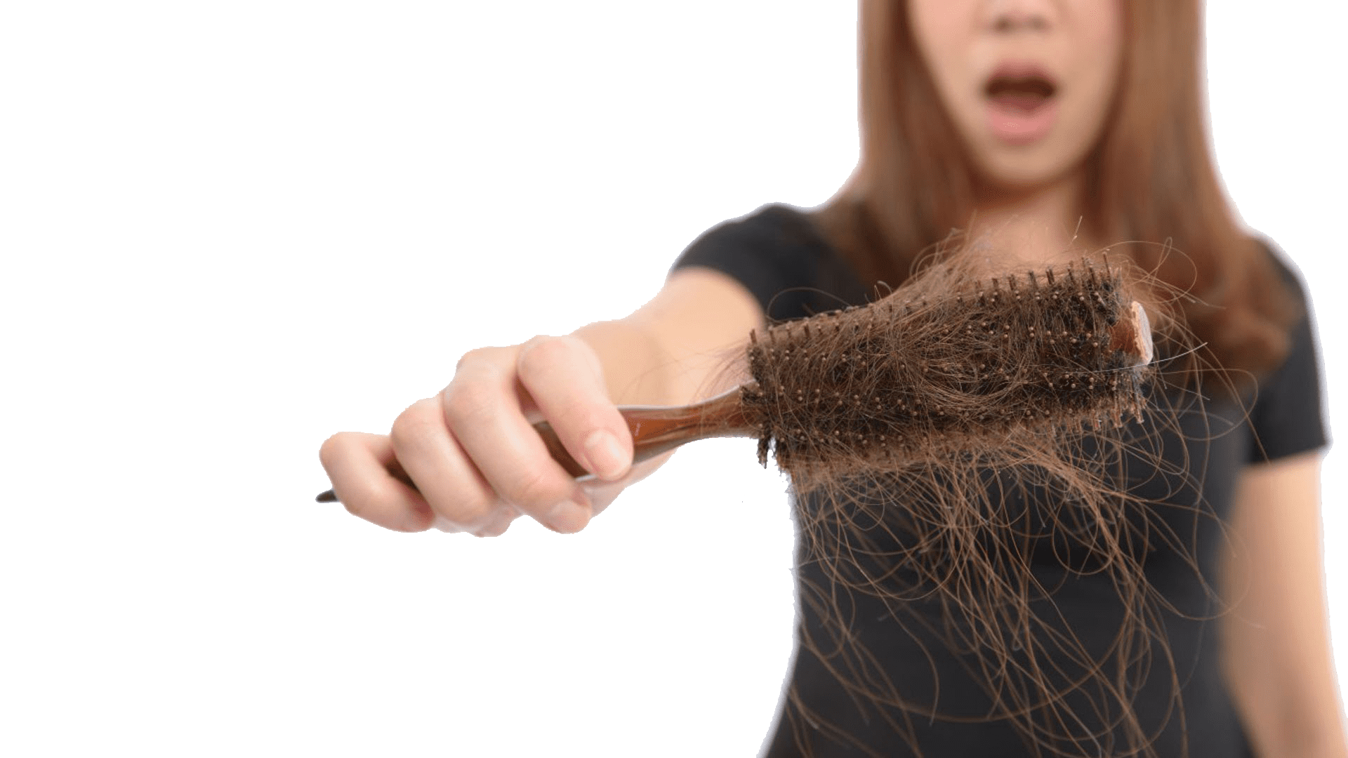 Best Hair Loss Treatment Healthstatus 2024